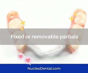 Fixed #dentures are non-removable dentures placed inside your #mouth as a denture device consisting of a row of prosthetic #teeth. At the same time, removable #partial dentures are temporary and can be removed after a certain period. . 📱Toll-Free: 1 855 988 4200. Phone: 915 308 0101 México: 656 625 9250 nucleodental.com . #NucleoDental #ElPasoTx🇺🇸 #CiudadJuarez🇲🇽 #NewMexico #dentalclinicnearme #oralcare #oralhealth | Nucleo Dental