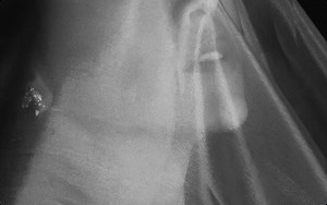 Genioplasty Brisbane - Chin Implant Brisbane & Chin Augmentation | Dr Sharp