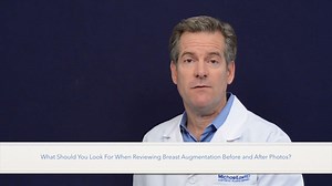 What to Look for in Breast Augmentation Before and After Photos